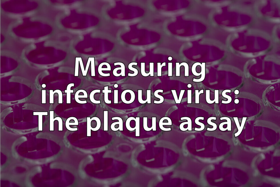 Measuring infectious virus: the plaque assay - VIROLOGY RESEARCH SERVICES